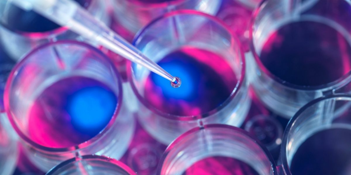 Managing Specialty Drug Costs | CarelonRx